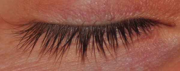 Gesichtssinn – KiwiThek